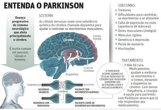 Doença de Parkinson - Diario Farma